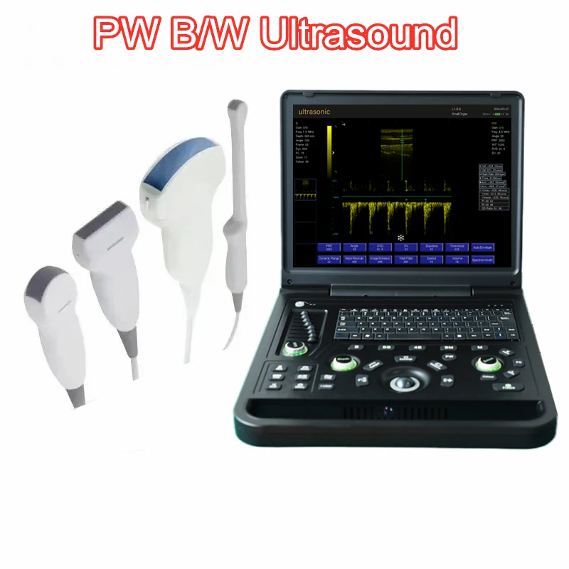 15-Inch-Large-LED-Screen-PW-ARM-System-Notebook-Ultrasound-USG-Scanner ...