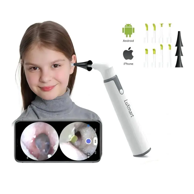 Wireless-Otoscope-Ear-Camera-with-Dual-View-3-9mm-720P-WiFi-Ear-Scope ...