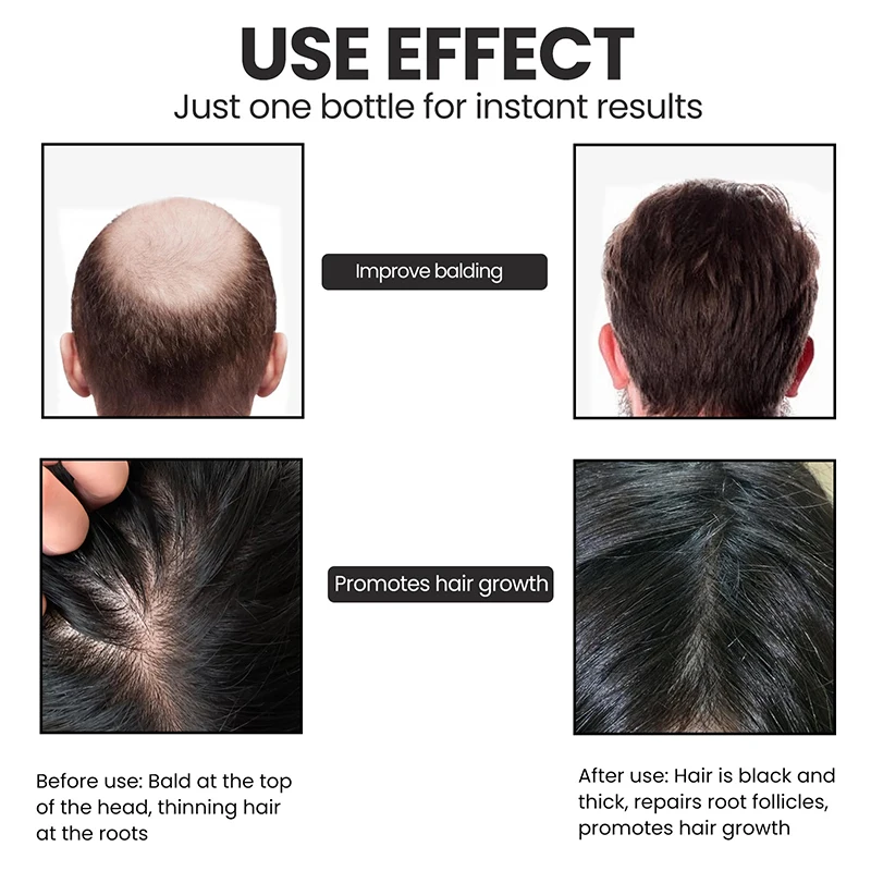 Thick Hair Men Scalp