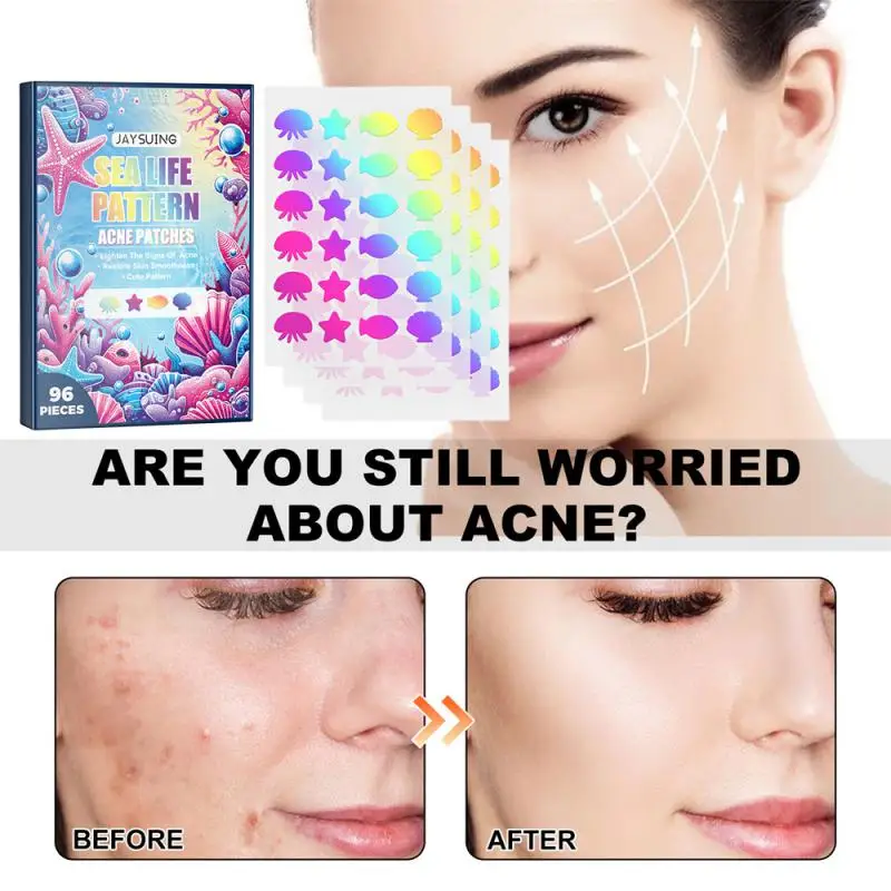 Safe-And-Comfort-Sterile-Acne-Patches-Skin-Care-Products-Colored-Acne ...