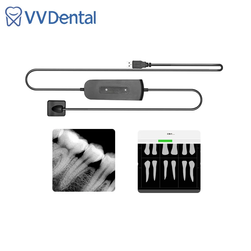 Sensor-Digital-de-rayos-X-Dental-sistema-de-imagen-de-frecuencia-HDR ...