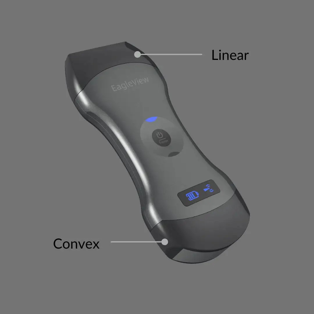 Wireless Handheld Ultrasound Scanner for Full-body Diagnostic - FitMed
