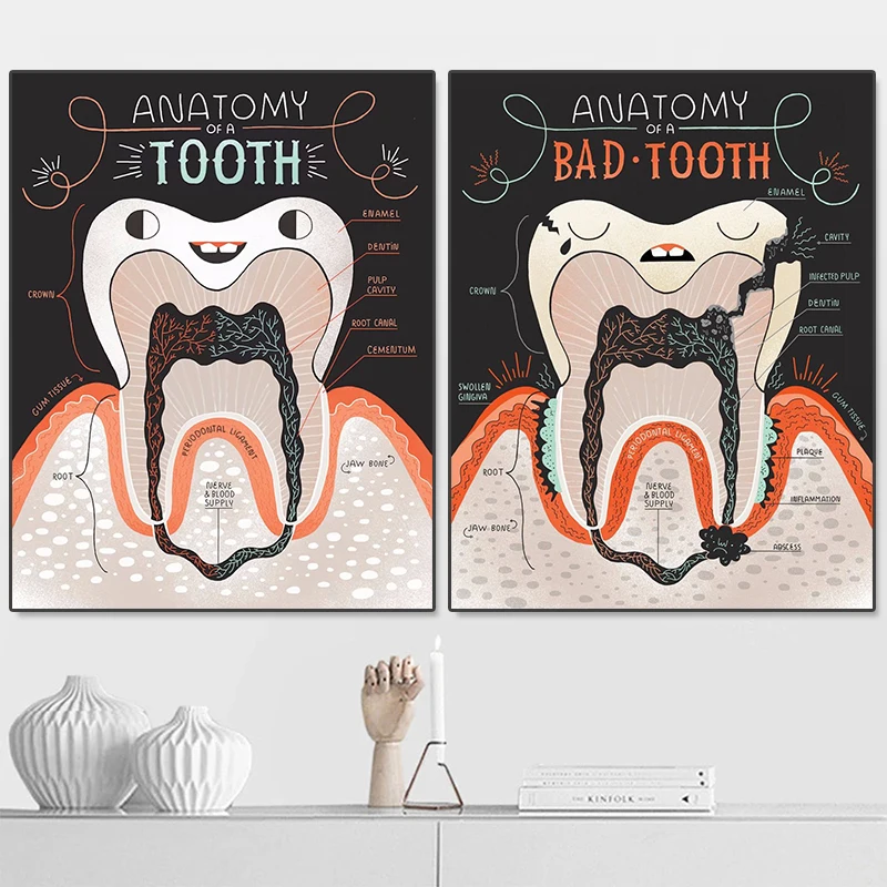 Anatomy-of-Good-and-Bad-Teeth-Wall-Art-HD-Picture-Dental-Science ...