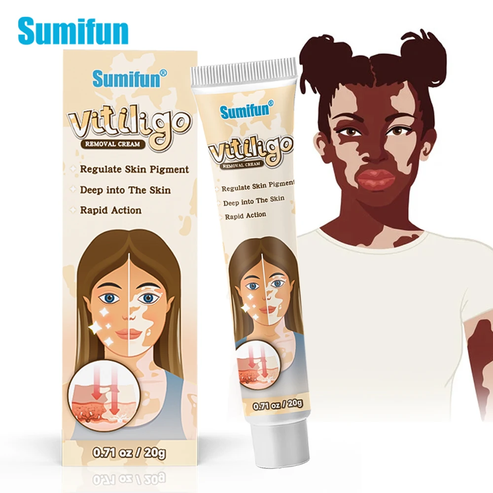 New Vitiligos Leukoplakia Diseases Treatments Ointment Spot Balm ...