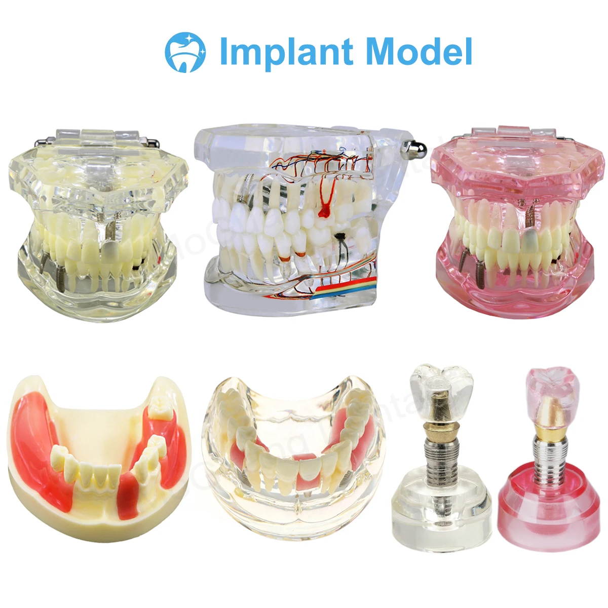 Dental-Teeth-Model-Implant-with-Removable-Tooth-Dental-Teaching-Model ...