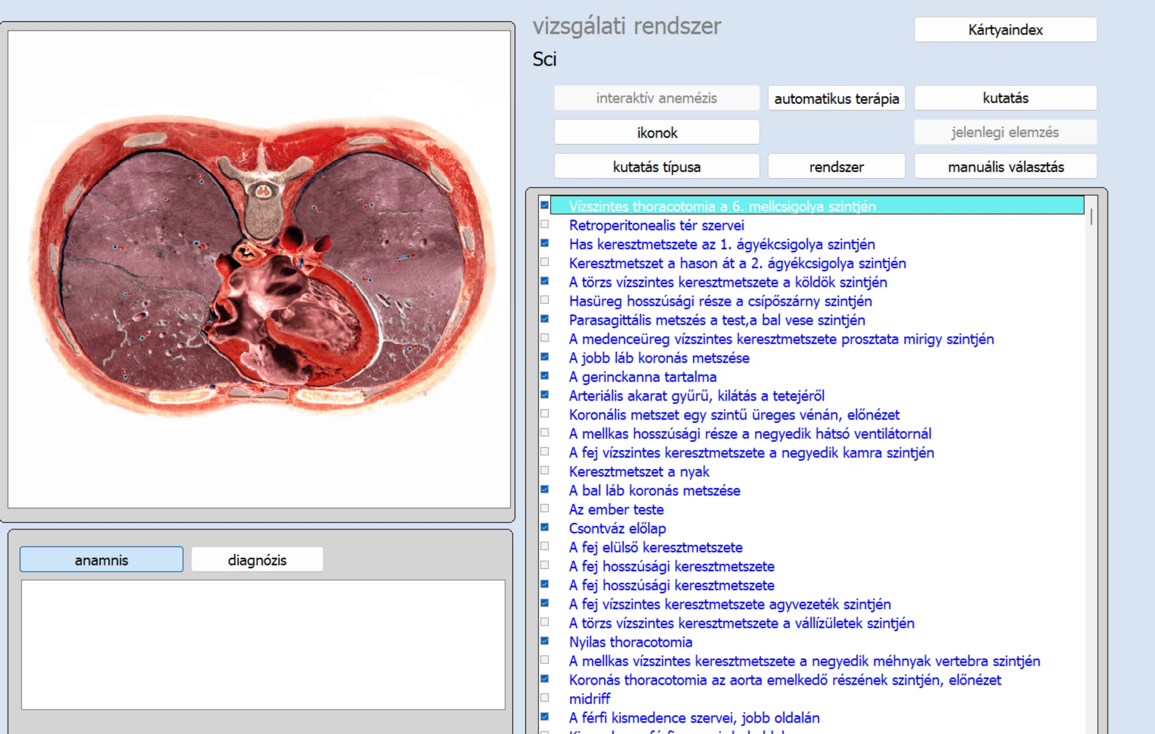 Aura Chakras Meta Hunter 4025 and 18D NLS Non-Linear Metatron System ...