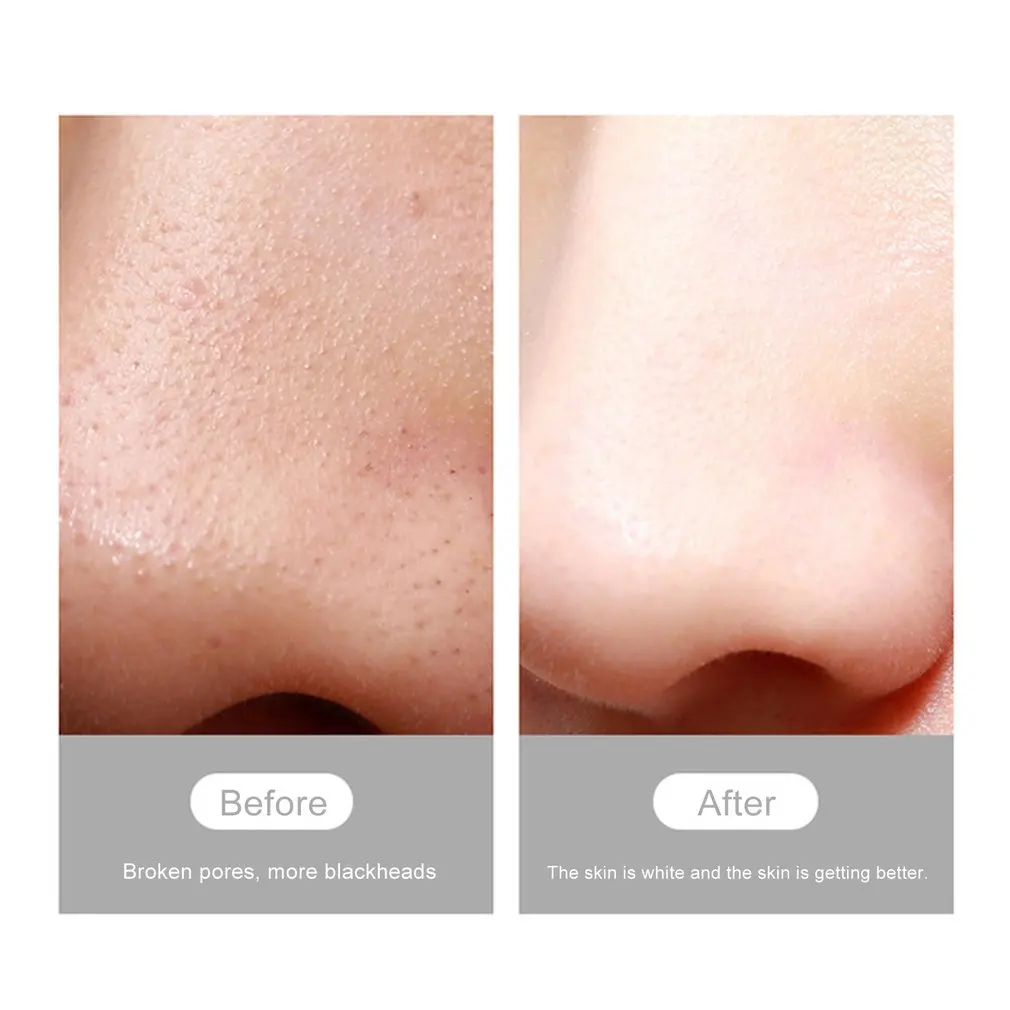 Skin Pore Microscope