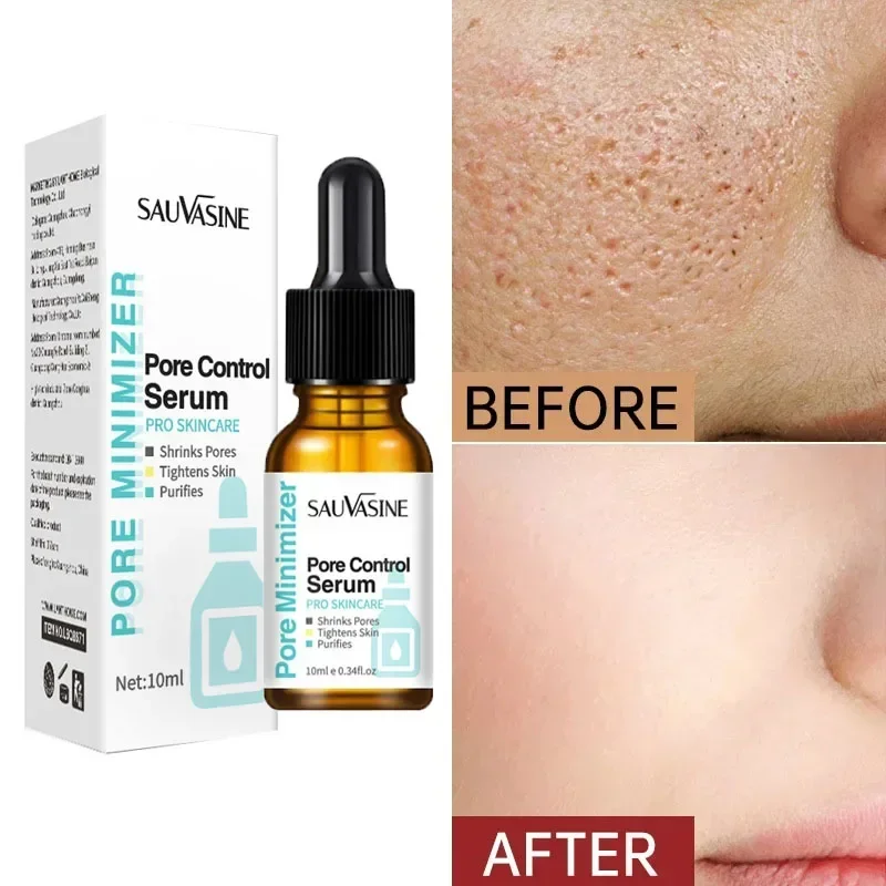 Pore-Shrinking-Face-Serum-Remover-Blackheads-Dark-Spots-Acne-Treatment ...