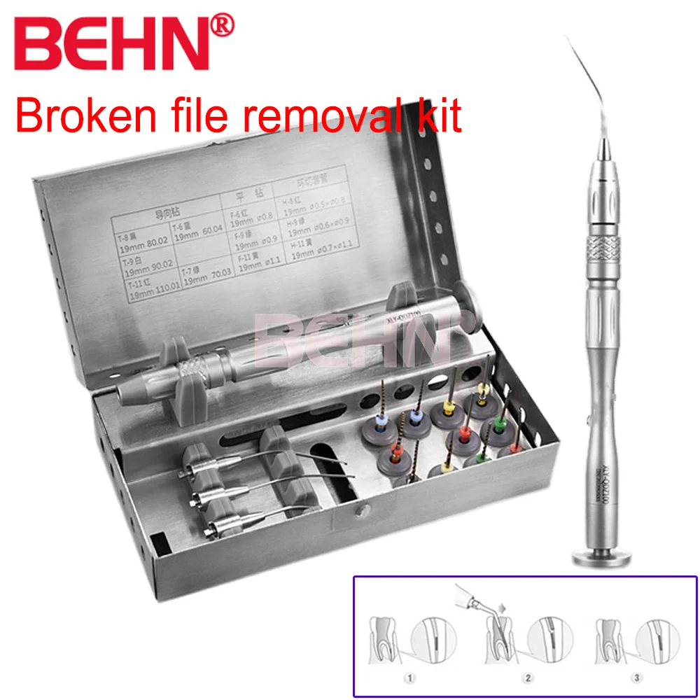Odontologia Dental Files Extractor Endo File Removal Holder Equipment ...