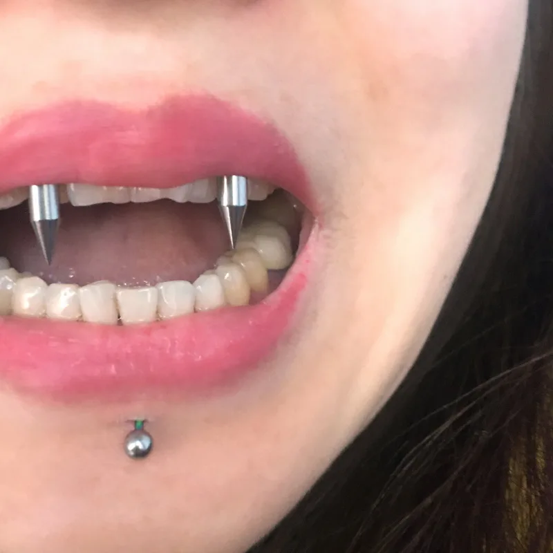 Labial Frenulum Piercing