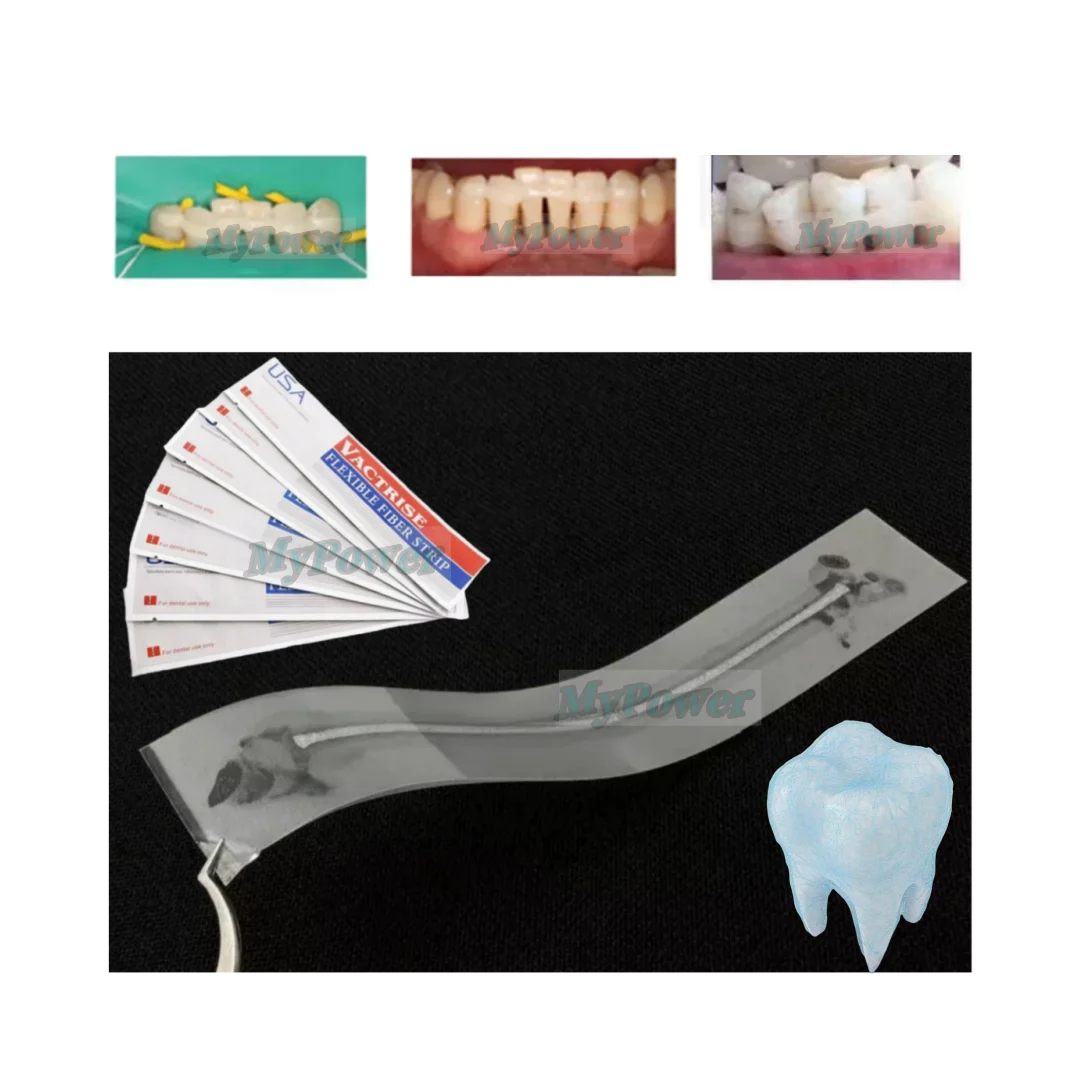 1Pcs-Dental-Fiber-Splint-Glass-Flexible-Fiber-Strip-Composite-Light ...