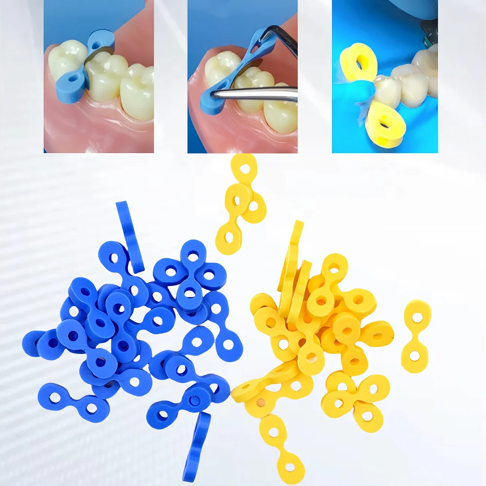 40-Pcs-Dental-Wedge-Matrix-Matrices-Dental-Tooth-Seperator-Elastic ...