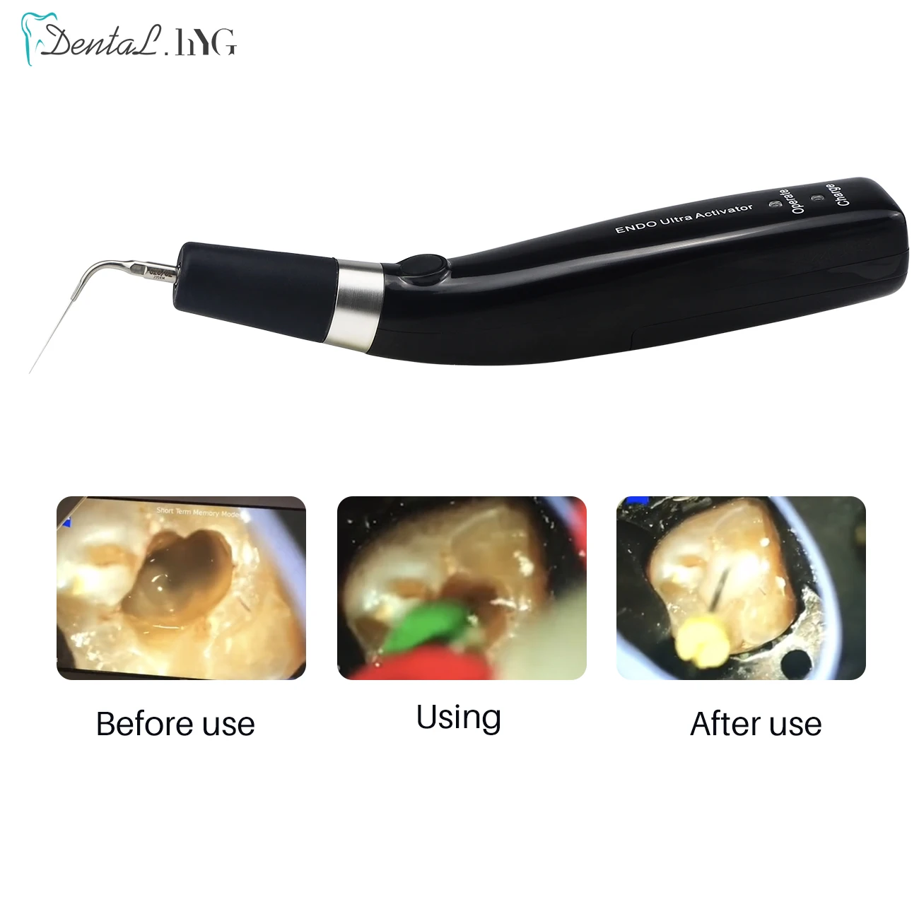 Dental-Ultrasonic-Activator-Wireless-Endodontic-Irrigator-Ultrasonic ...