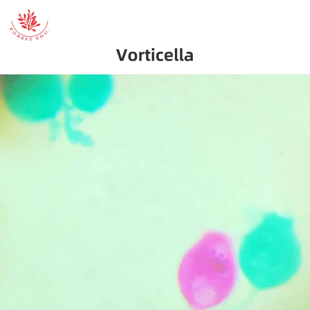 Vorticella Slide Labeled