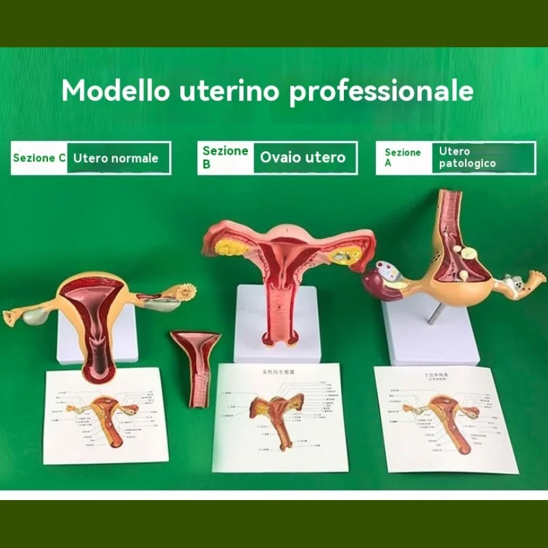 Pathological Uterine and Ovarian Models, Female Reproductive System ...