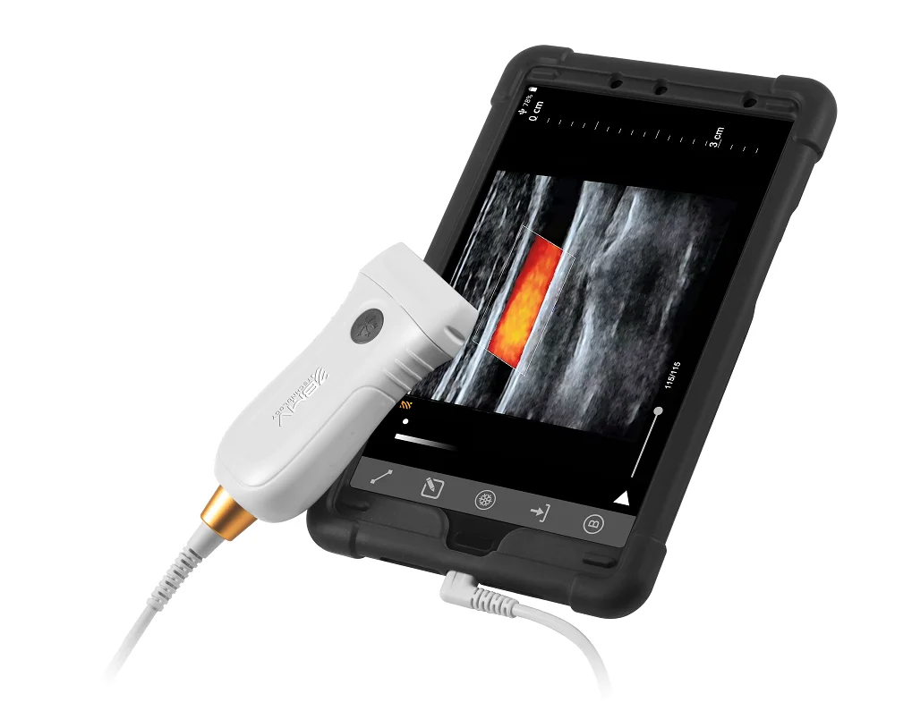 USB-Ultrasound-Medical-Scans-Convex-Linear-Ultrasound-Probe-Intelligent ...