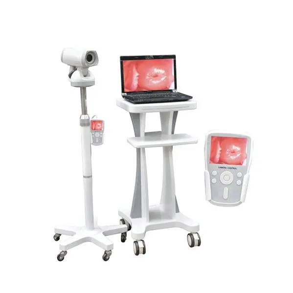 Endosc-pio-m-dico-para-ginecologia-colposc-pio-port-til-v-deo-digital.jpg