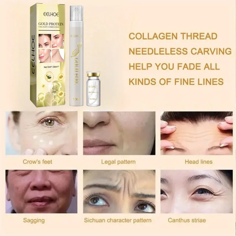Collagen Thread Instant Lifting Wrinkle Remover Soluble Protein Threads ...