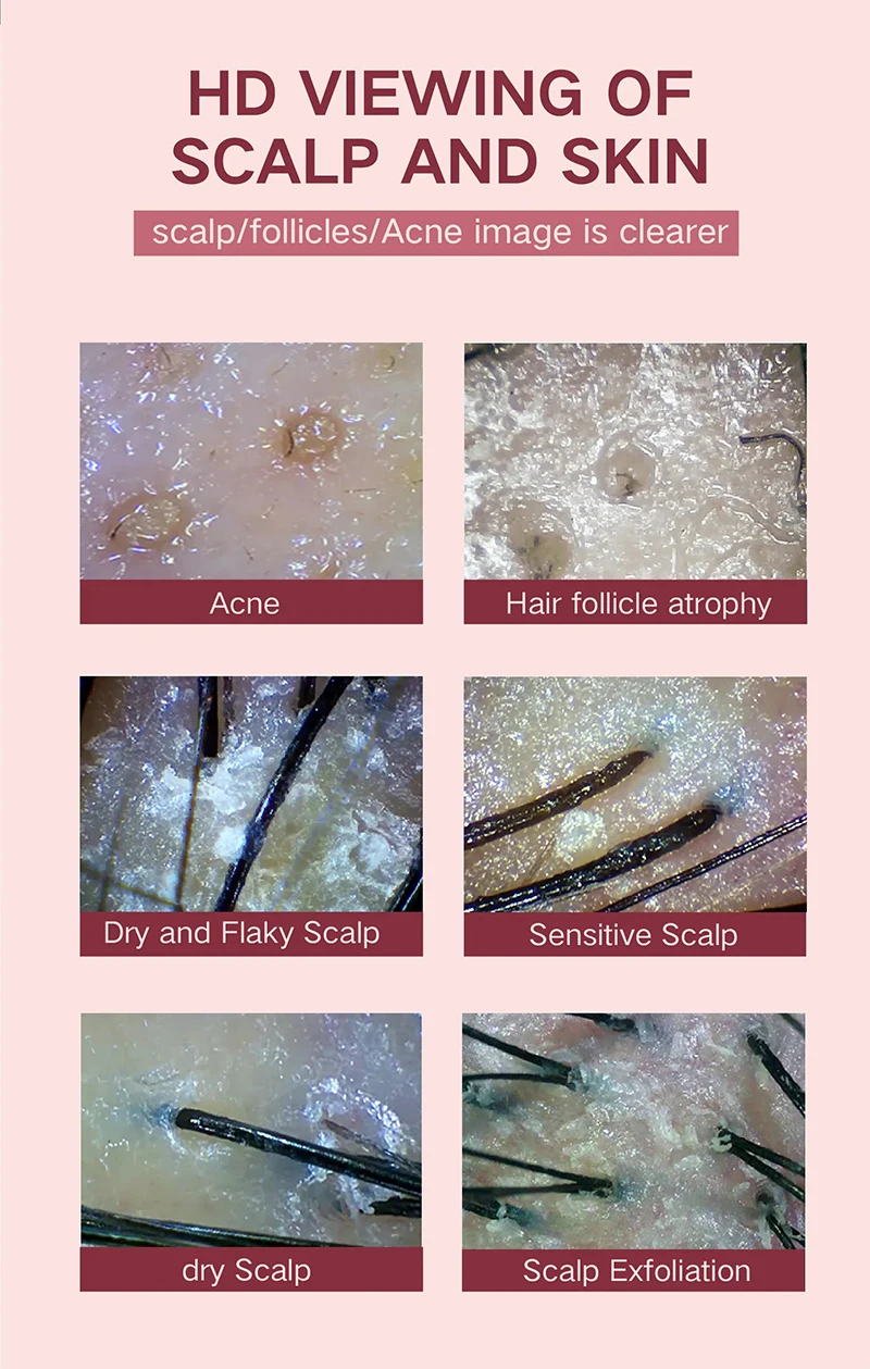 Wireless Digital Wifi Microscope Smart Hair Scalp Skin Analyzer Hair ...