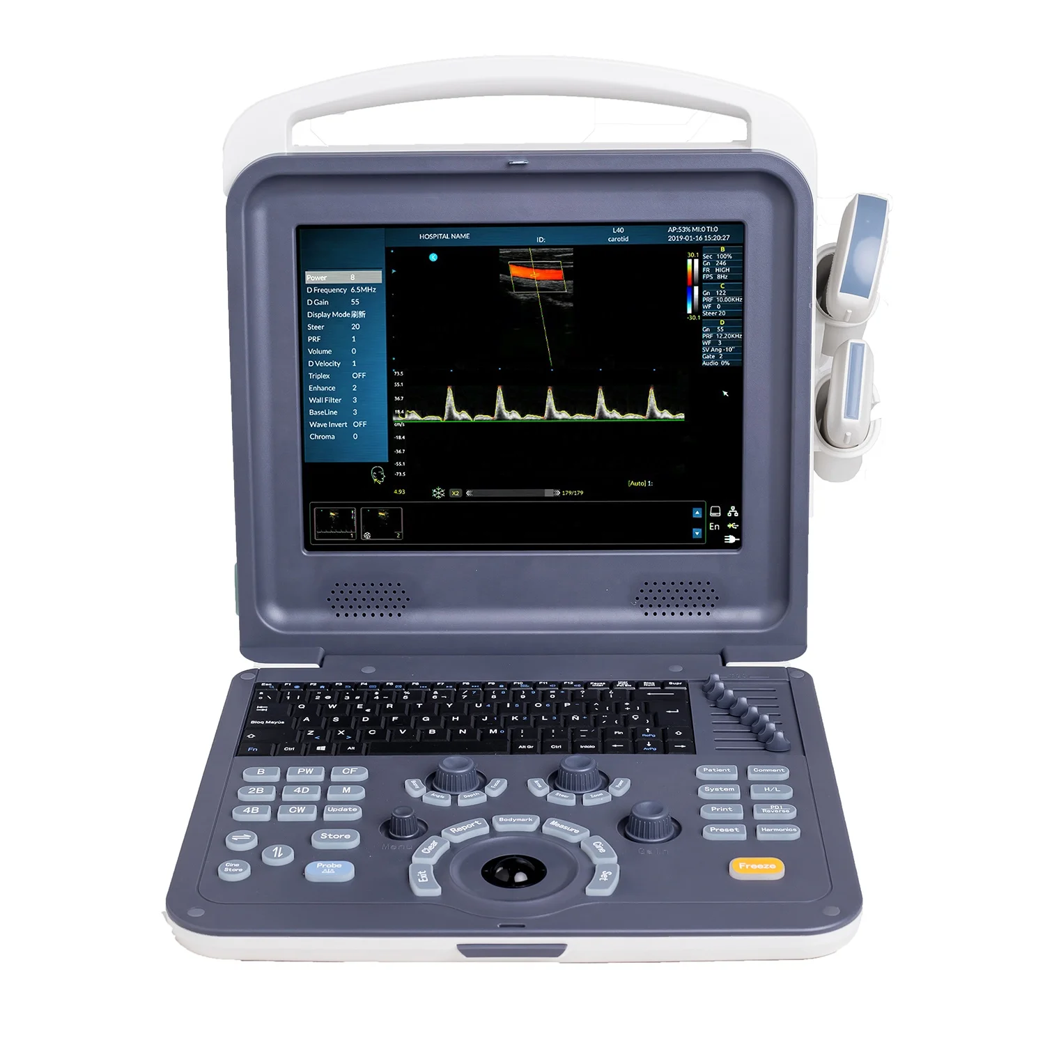 Portable-Full-Digital-Diagnostic-Color-Doppler-2D-Ultrasound-Scanner ...