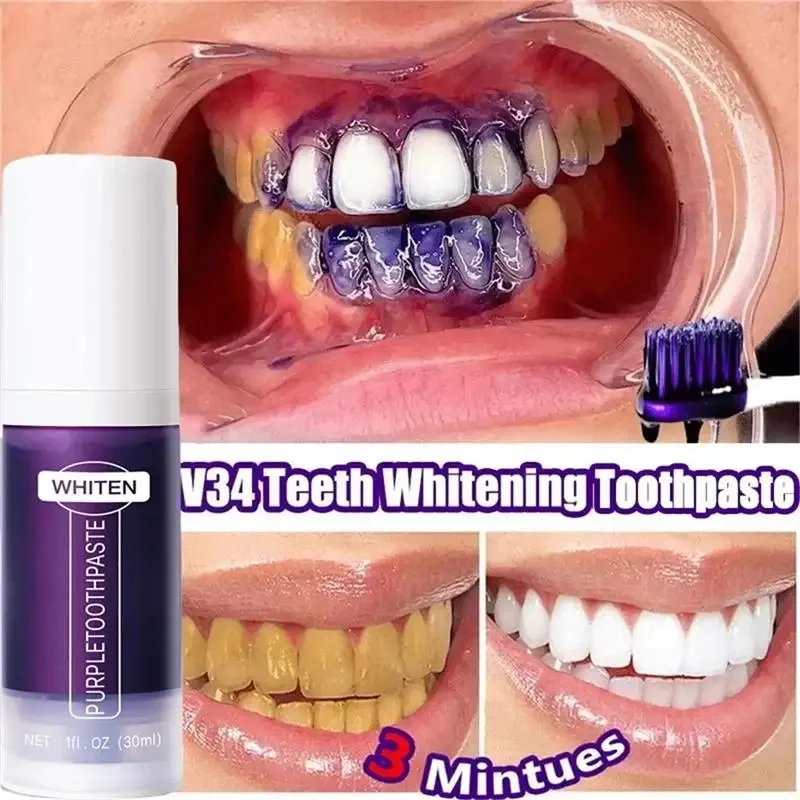 New-V34-Teeth-Whitening-Toothpaste-5D-Teeth-Whitening-Stick-Oral ...