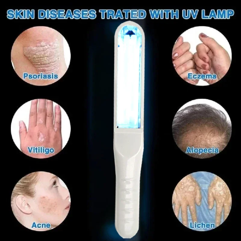 UVB-311nm-ultraviolet-lamp-for-the-treatment-of-vitiligo-Uvb-Phototherapy-Narrow-Uv-Phototherapy ...