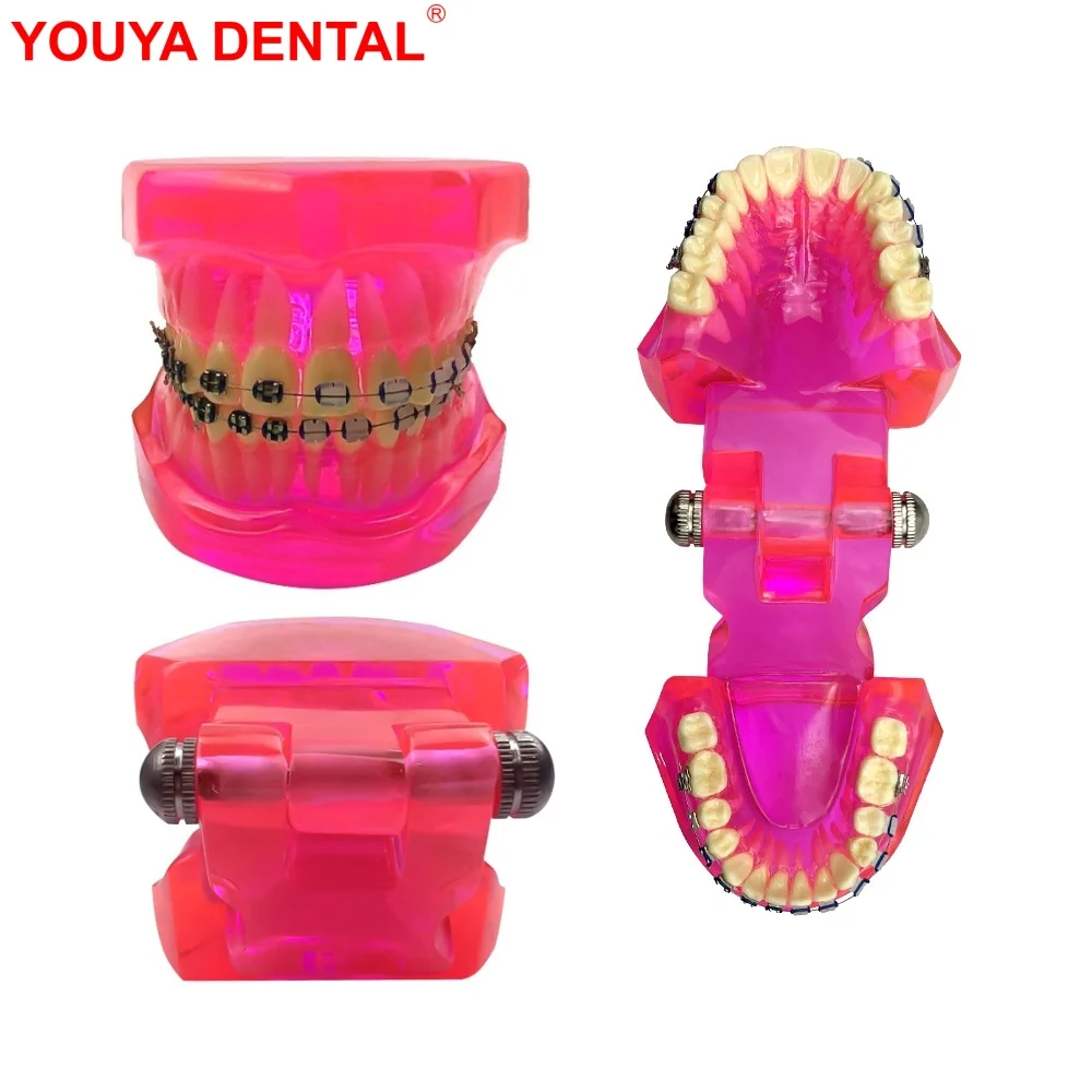 Ortho Dental Teeth Model Half Metal Half Ceramic Dentistry Orthodontic ...