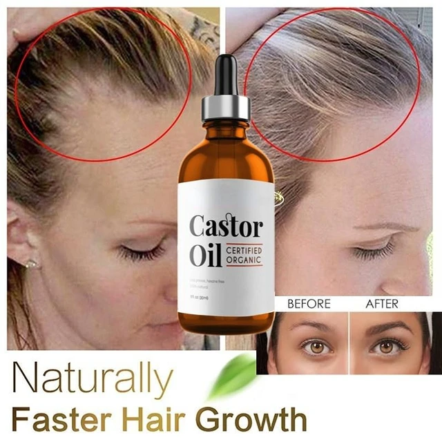 Castor Oil For Hair Growth Eyebrows