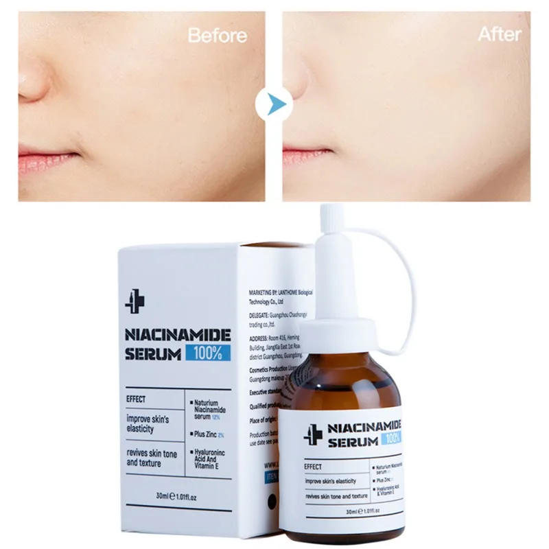 Nicotinamide Original Liquid Light Acne Print Moisturizing Brightening ...