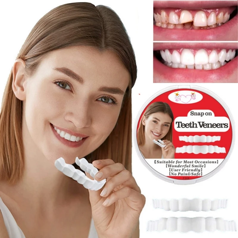 Fake-Tooth-Cover-Snap-On-Teeth-Veneers-For-Men-And-Women-Cover-The ...