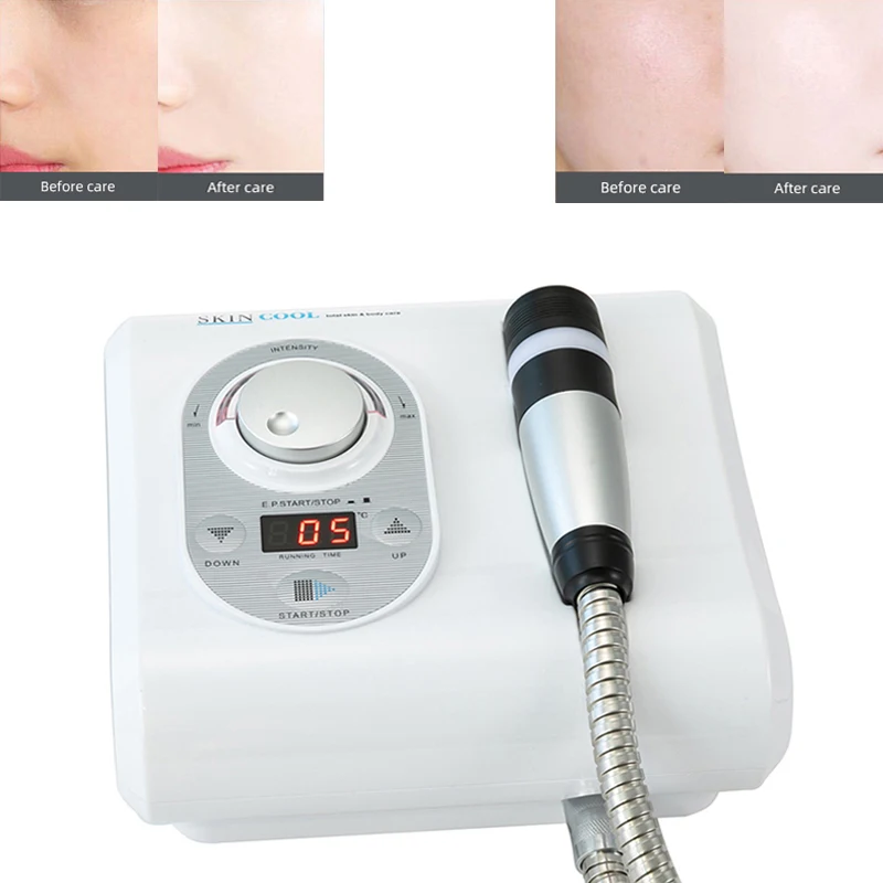 Portable Cool + Hot Facial Electroporation Cryotherapy RF Beauty ...
