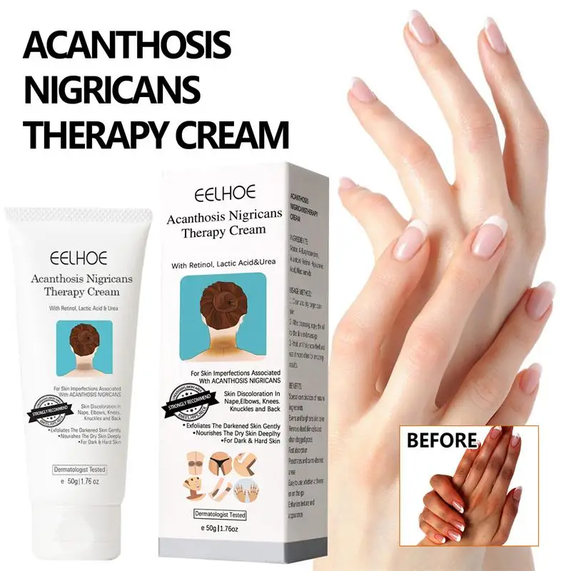 Brighten Cream Bleaching Armpits Elbows Knees Moisturizing Body Lotion ...