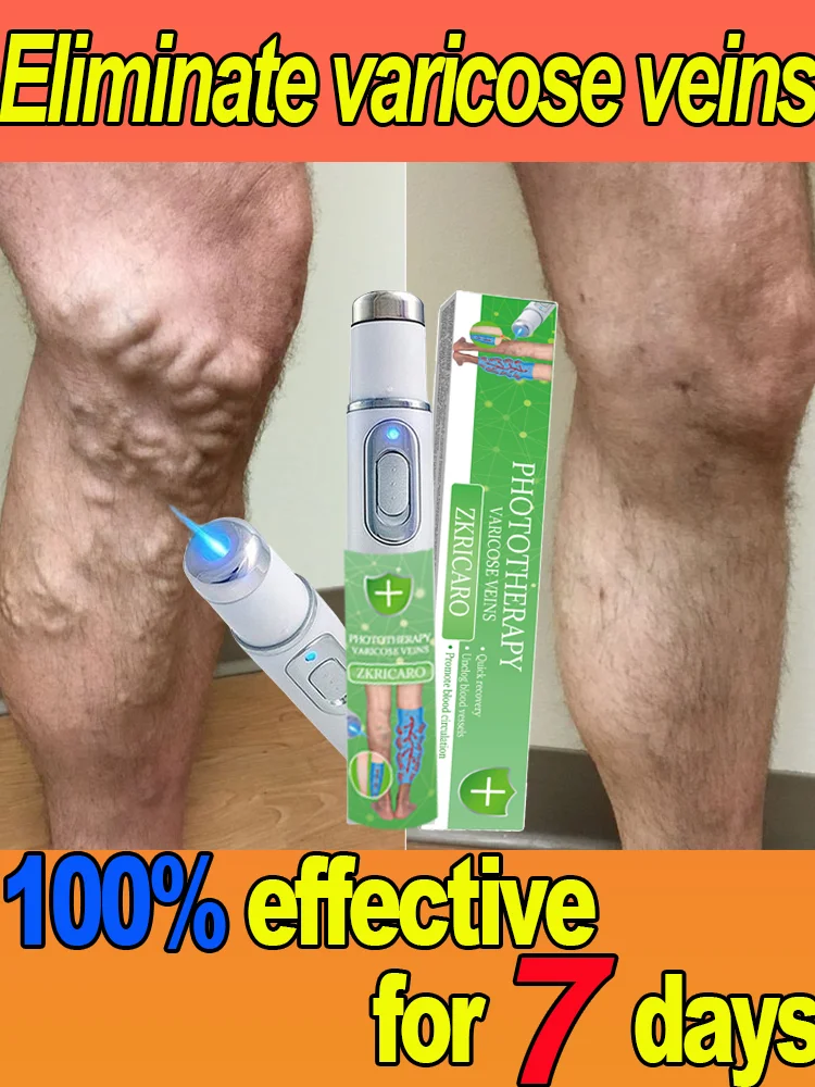 Powerful-Laser-Therapy-for-Moderate-Varicose-Veins-Clear-varicose-veins ...
