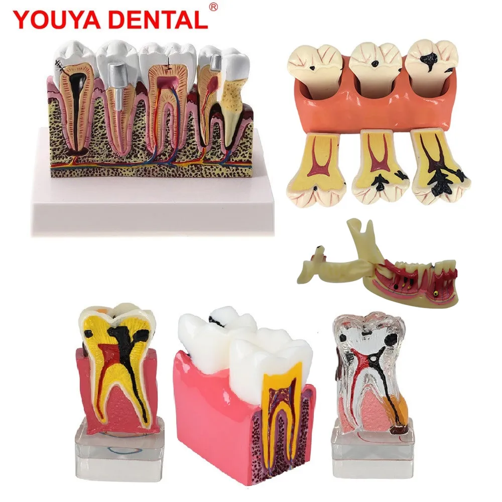 Anatomía Dental modelo Dental enseñanza estudio modelo anatómico Dental ...