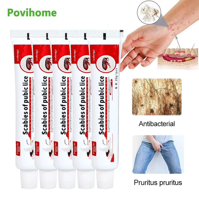 Treatment For Pubic Lice