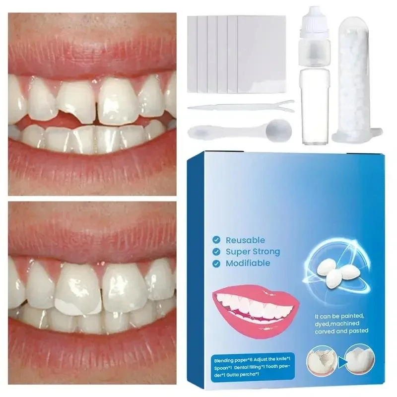 How I Fixed My Cracked Molar At Home With a Permanent-Tooth-Filing Kit ...