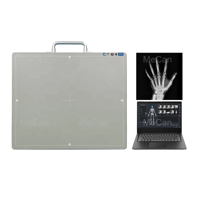Digital Radiography X Ray Flat Plate Panel Detector China, 43% OFF