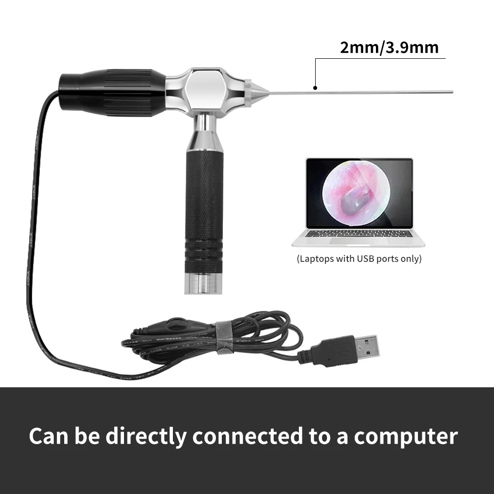 Smart-Ear-Cleaner-Endoscope-4LED-2mm-USB-Ear-Otoscope-Earwax-Remover ...
