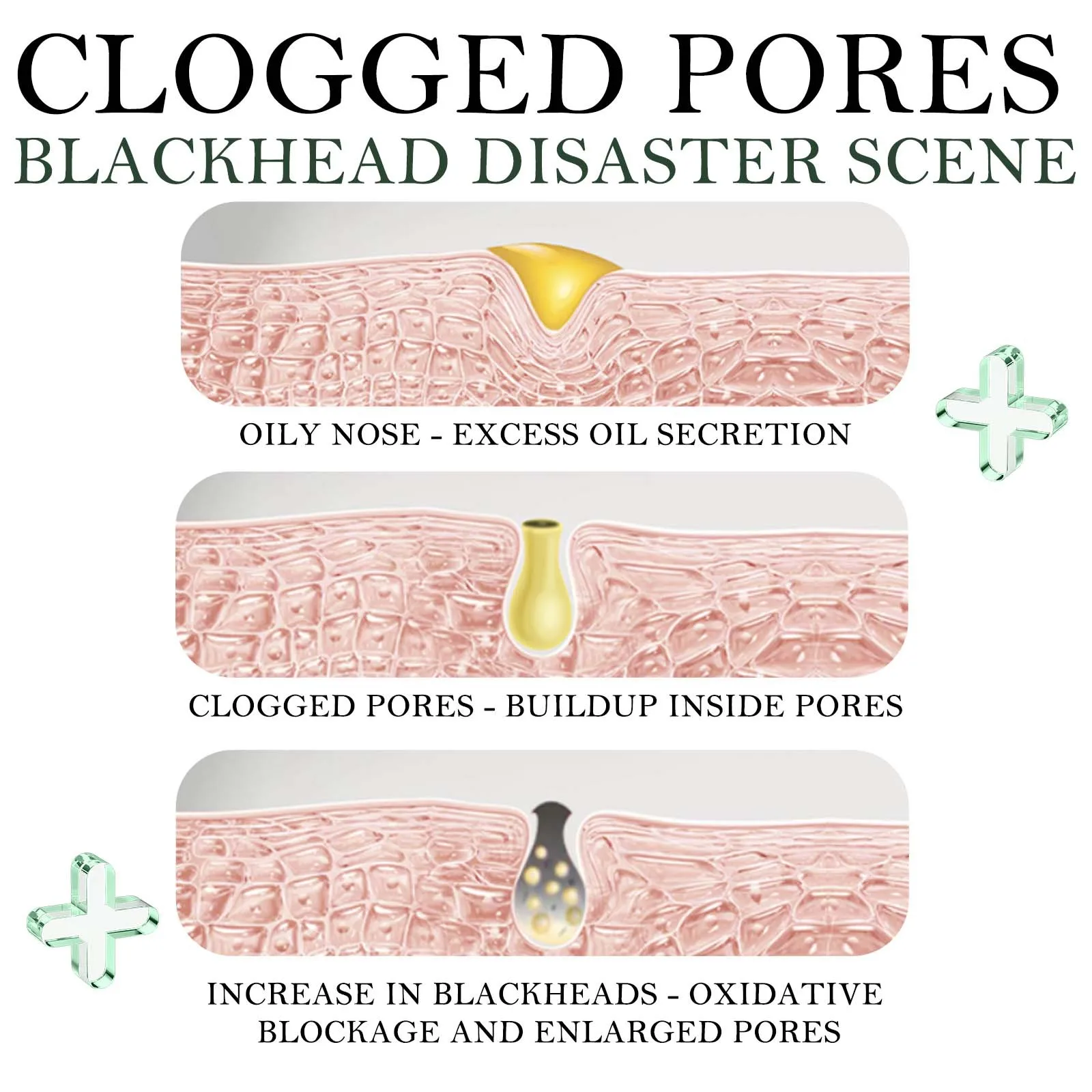 Clogged Pores On Face Diagram