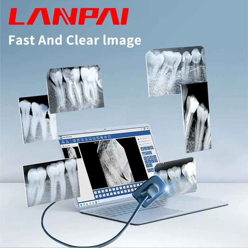Lanpai-Dental-Radiovisograph-Sensor-Rx-Digital-portable-x-ray-Sensor ...