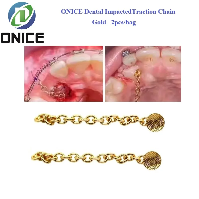 5Bags-ONICE-Dental-Impacted-Cuspids-Traction-Chain-Dental-Lingual ...