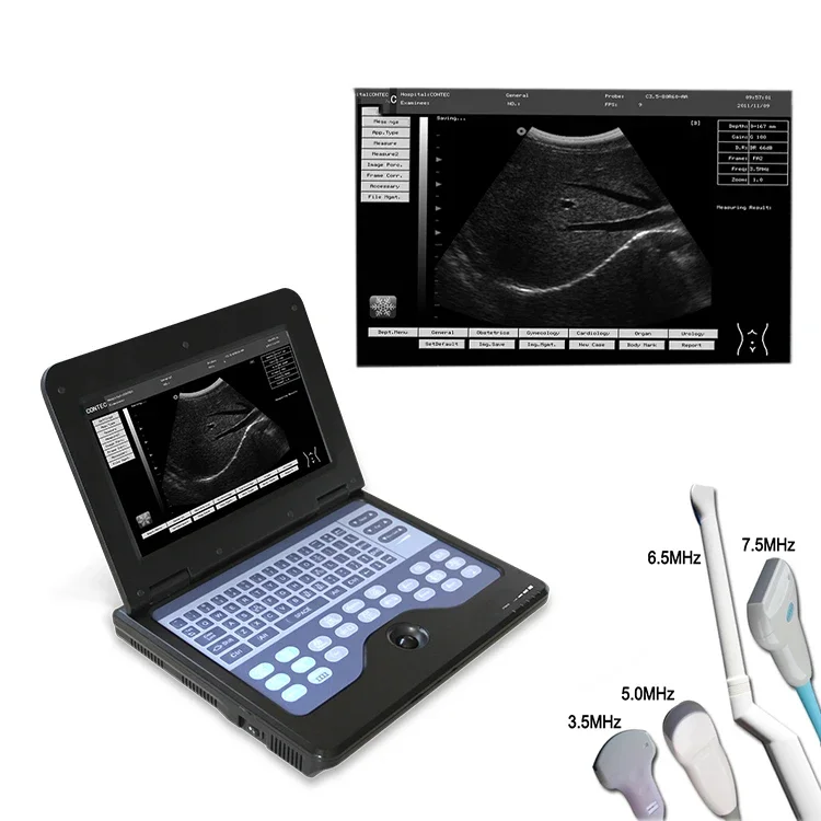 CONTEC-CMS600P2-ultrasonic-machine-portable-ultrasonic-diagnostic ...