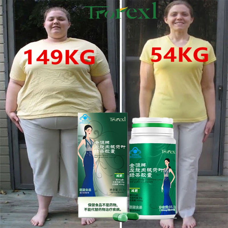 60pcs Weight Lose Product L-carnitine Slimming Diet Pills Reduce ...