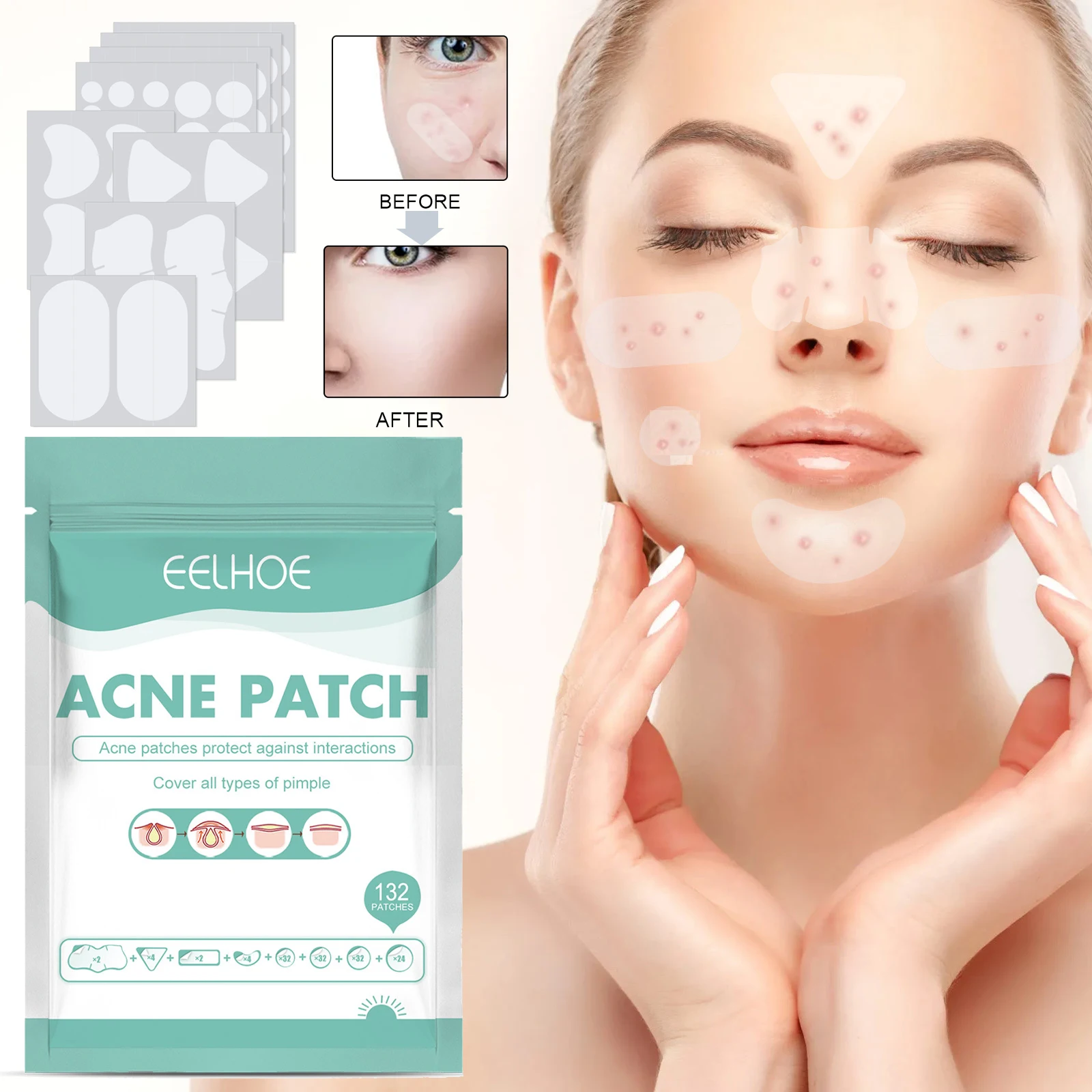 132Pcs-Invisible-Removal-Pimple-Anti-Acne-Hydrocolloid-Patches-Spots ...