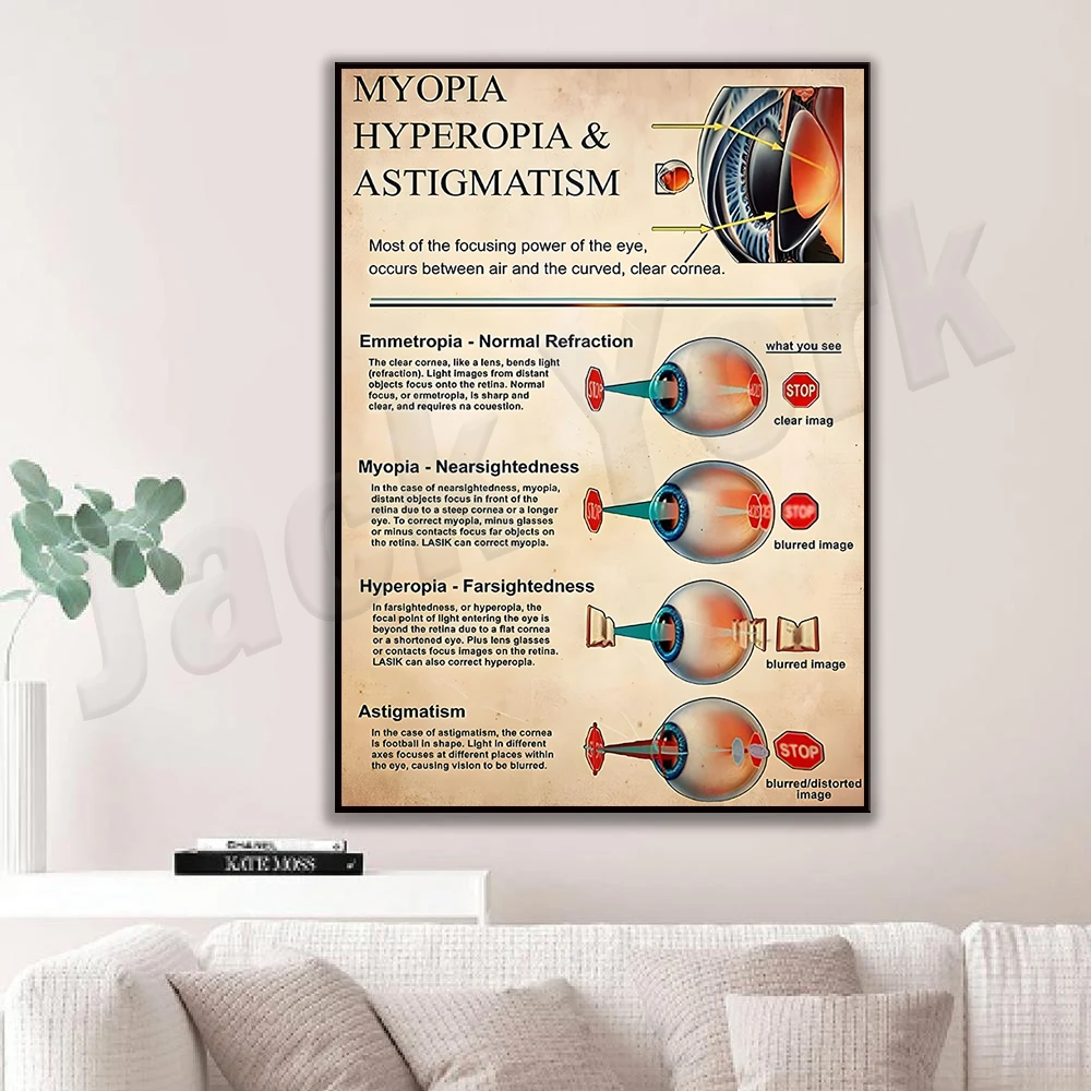 Myopia Hyperopia Astigmatism