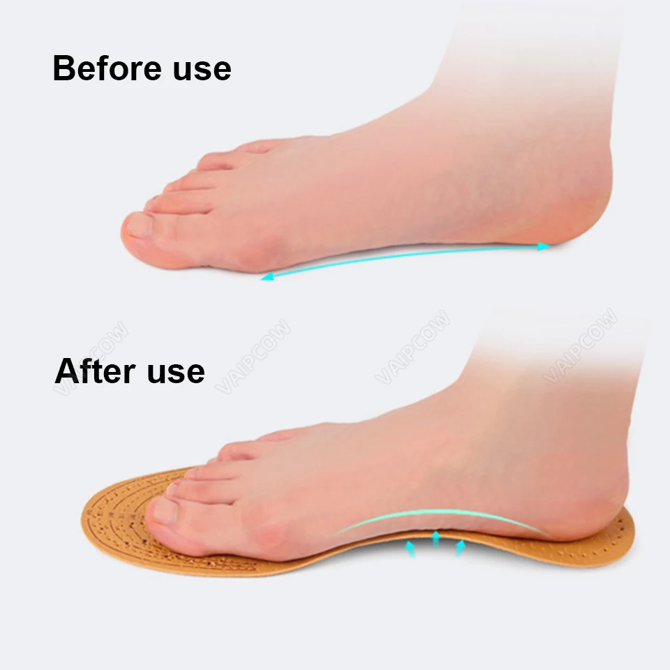 Best Insoles For High Arches