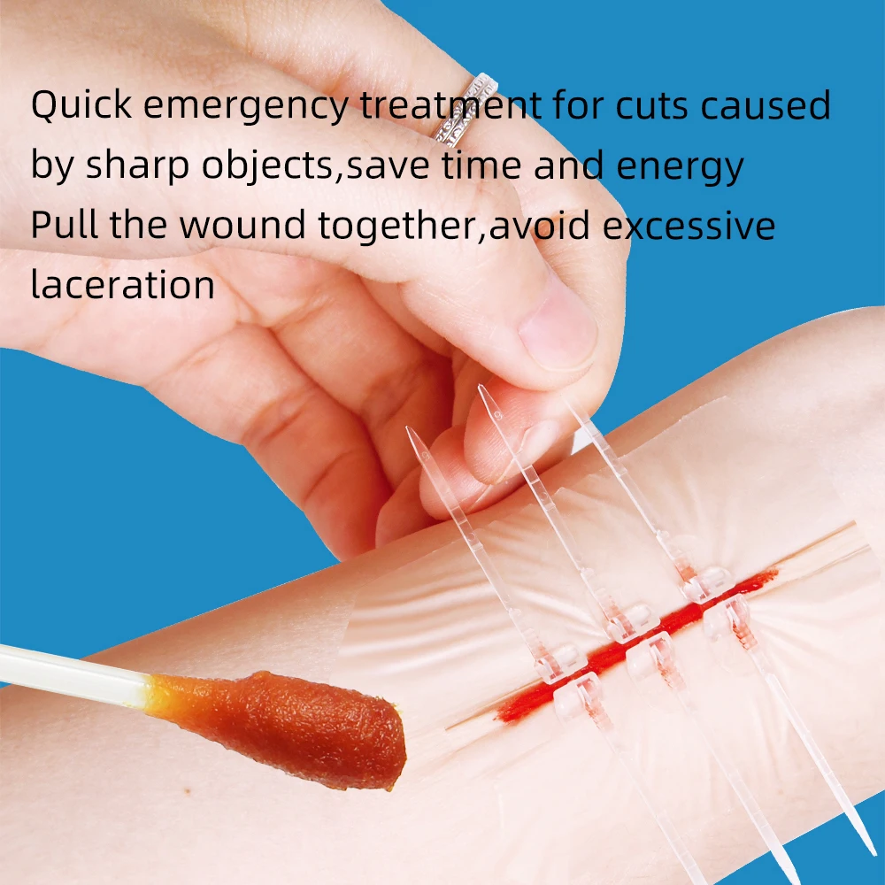 Zipper-Band-Aid-Wound-Closure-Device-Wound-Tie-Emergency-Repair-Wounds ...