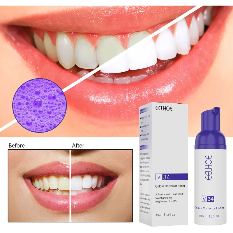 V34-Dental-Care-Products-Purple-Safe-Teeth-Whitening-Toothpaste-Teeth ...