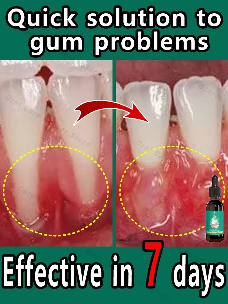 Effectively-repair-damaged-gums-relieve-toothache-strengthen-teeth-and ...