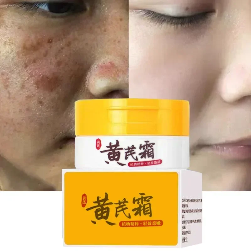 50g-Huangqi-Cream-Freckle-Removing-Whitening-Removing-Yellowish-Brown ...